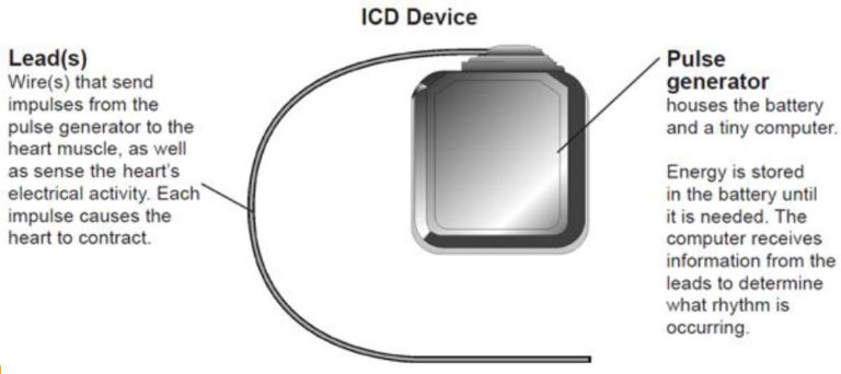IMPLANTABLE DEFIBRILLATORS (ICD) - Dr.PL. SaravananDr.PL. Saravanan